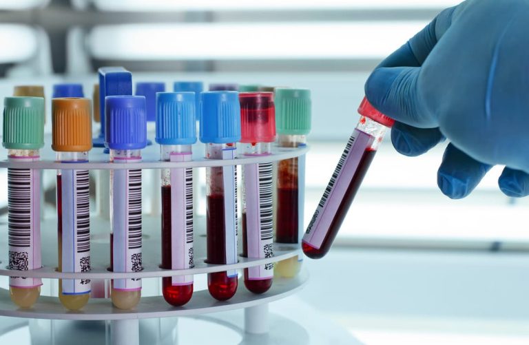 Clinical & Hematology | Blood Testing | Med-Lake Laboratory